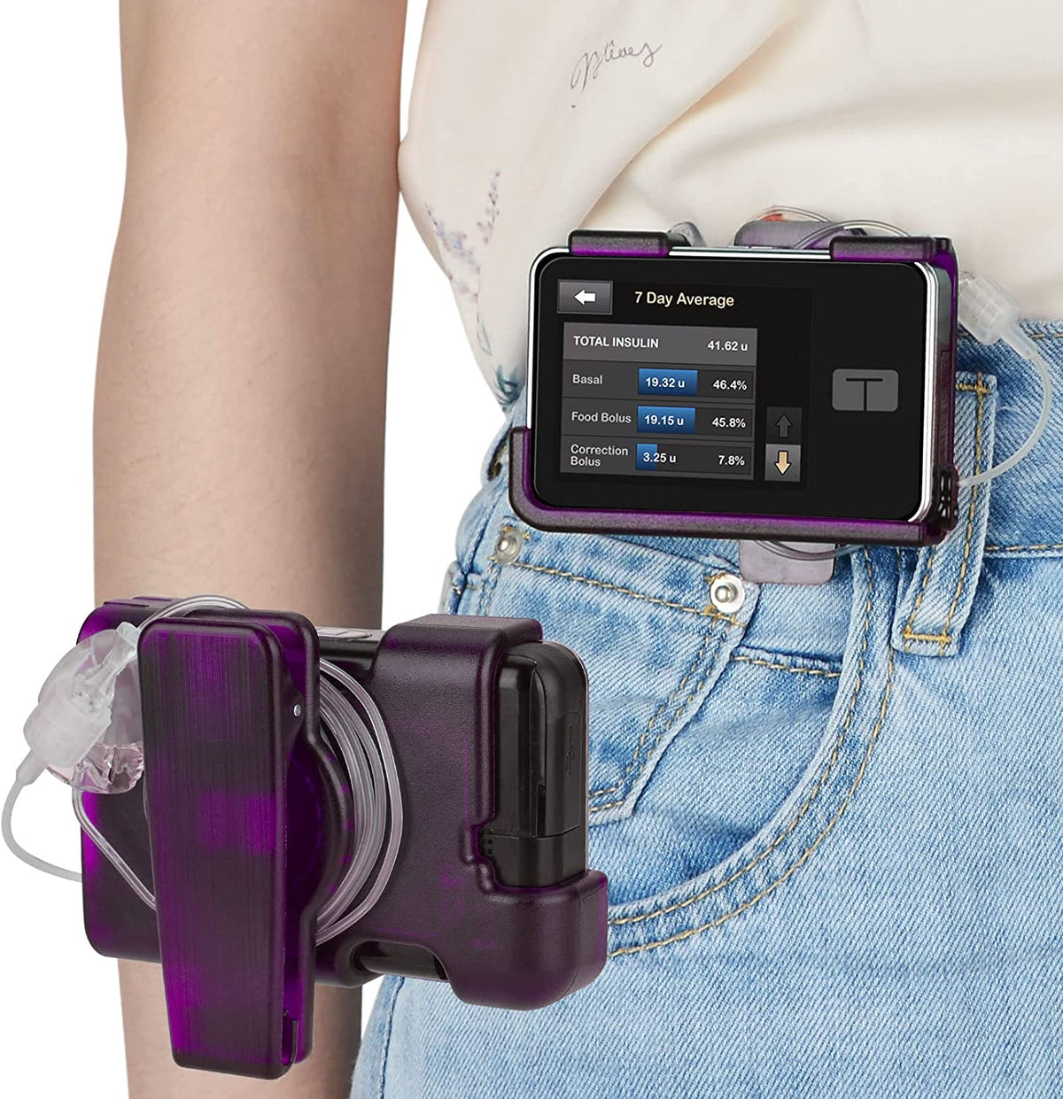 360° Rotating Case for tSlim X2 - Tandem Insulin Pump Holder for t:Sli ...